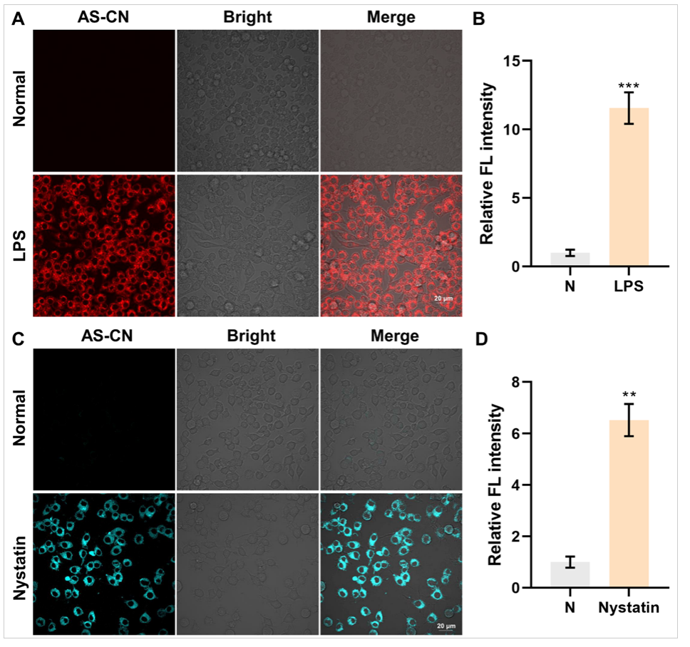 A two-pronged detection of atherosclerosis with a dual-channel ...