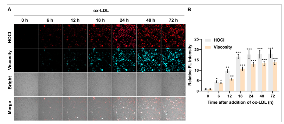 A two-pronged detection of atherosclerosis with a dual-channel ...