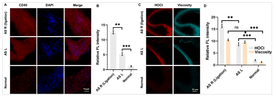 A two-pronged detection of atherosclerosis with a dual-channel ...